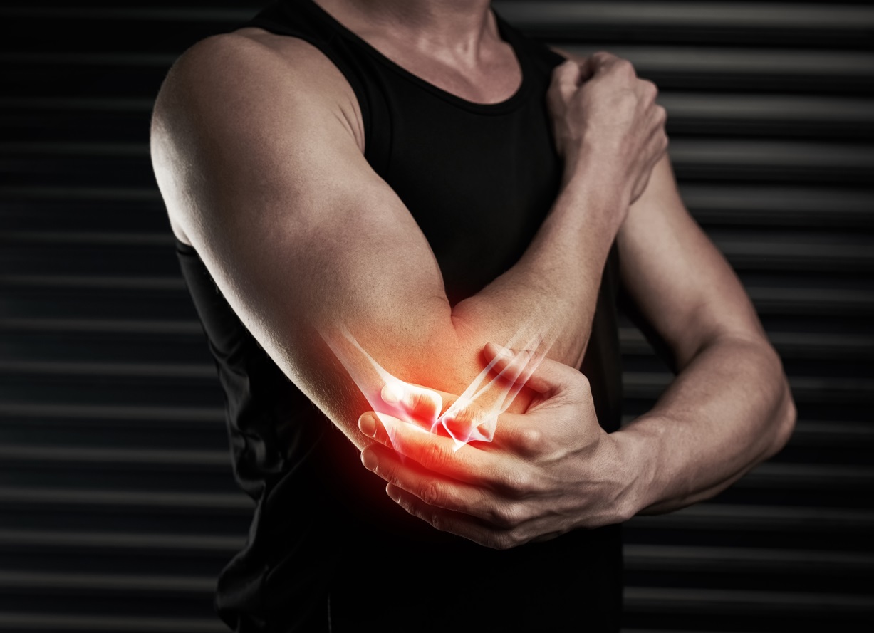 Elbow Tendonitis - NOVA Pain & Rehab Center